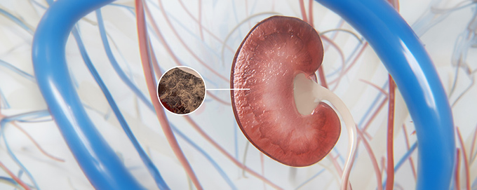 On a Quest to Crack the Kidney Disease Conundrum | Zoetis