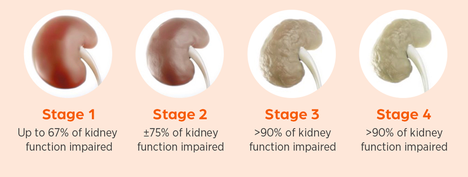 On a quest to crack the kidney disease conundrum | Zoetis