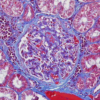 On a quest to crack the kidney disease conundrum | Zoetis
